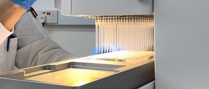 Automated pipetting for diagnostics | INTEGRA