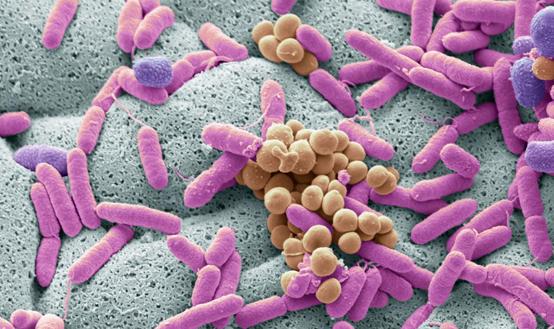 Understanding shotgun sequencing | INTEGRA